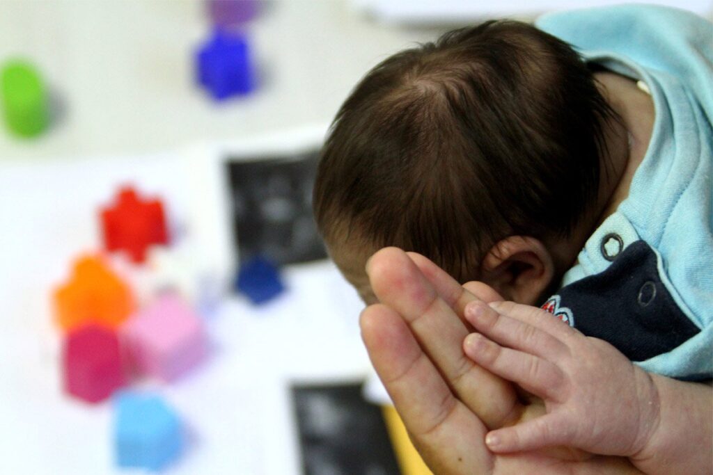 Microcefalia – IME Clínica Cidadã | Blog