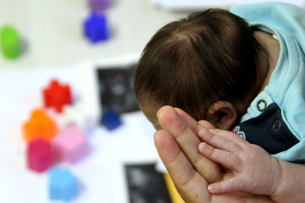 Microcefalia – IME Clínica Cidadã | Blog